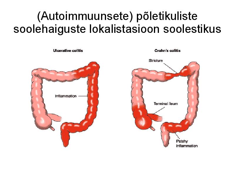 Seedeelundite haigused - Esitlus Kõne | Bioloogia