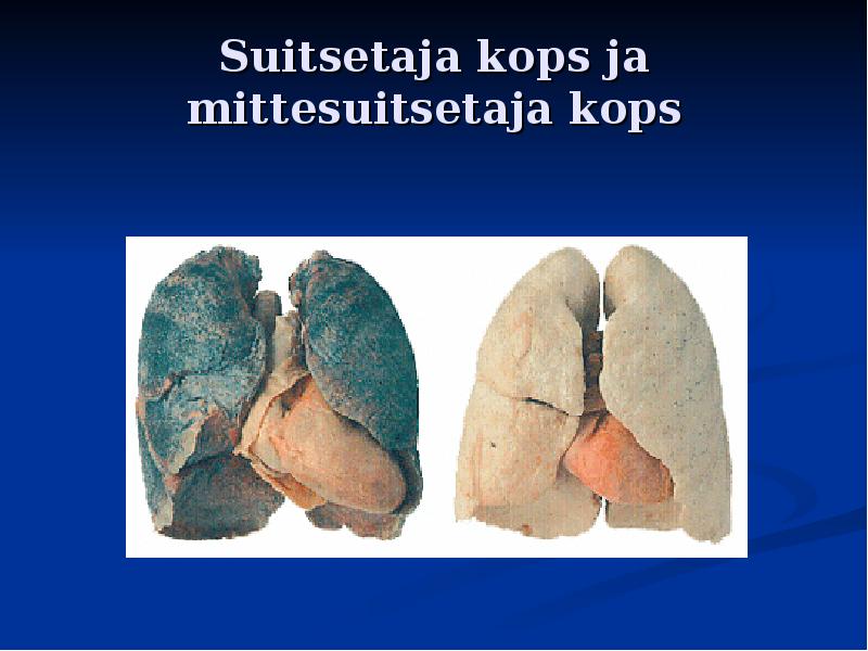Suitsetamise kahjulikkus | Informaatika - Arvuti õpetus